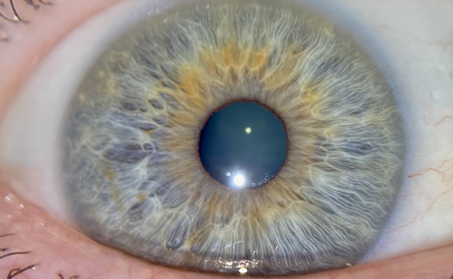 L’iridologie - Nadine Brunellière Naturopathe